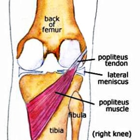 Popliteus Tendinitis Causes with Relief Tips - Pro Knee Pain Relief